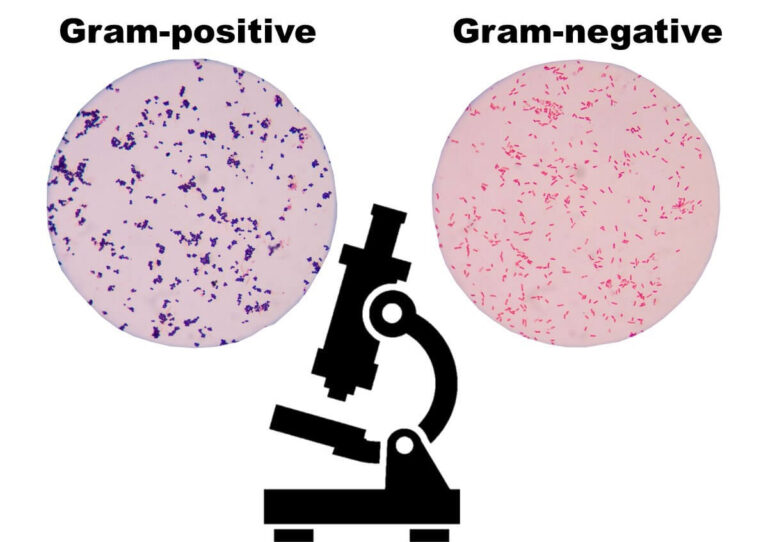 Gram Staining: Principles, Methods, and Procedures | Introduction to ...