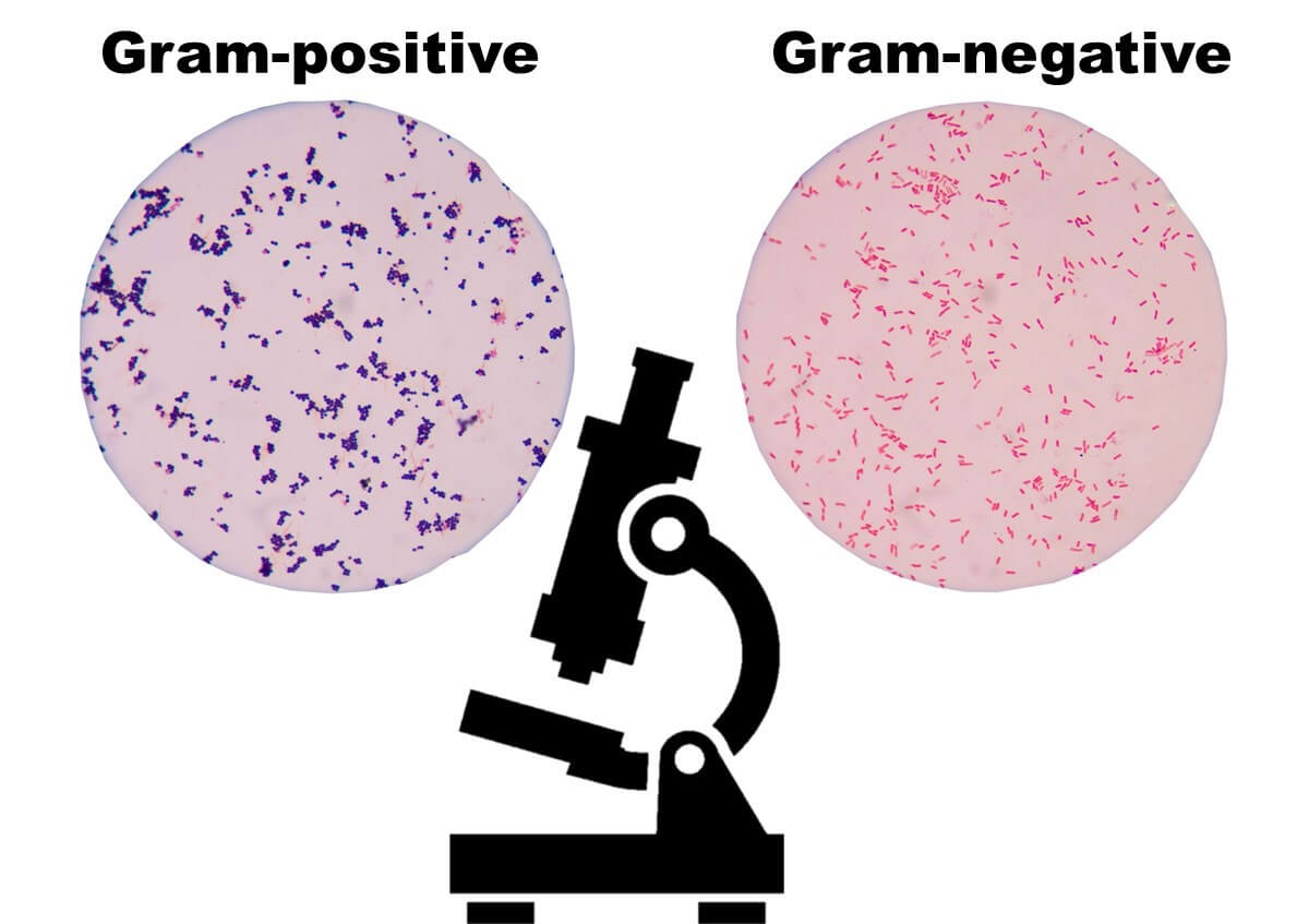 Gram Staining: Principles, Methods, and Procedures | Introduction to ...