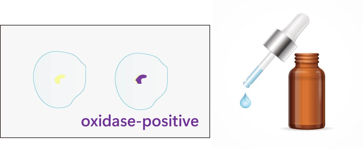 Essential Guide to the Oxidase Test: Key Method for Identifying Gram ...