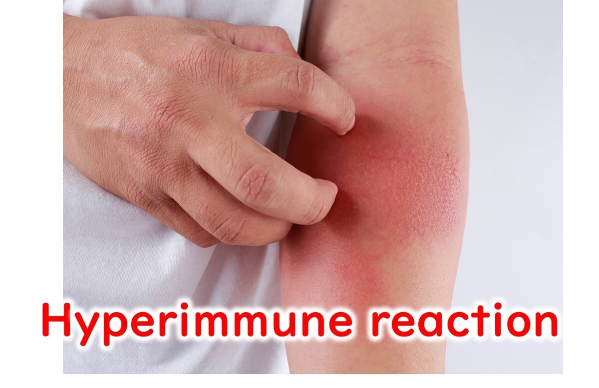 Exploring Staphylococcus aureus: From Skin Infections to Foodborne ...