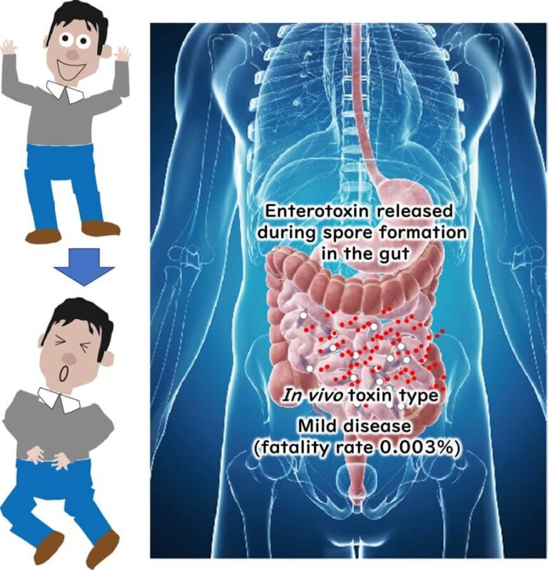 Clostridium perfringens: How to Prevent Food Poisoning from the ...